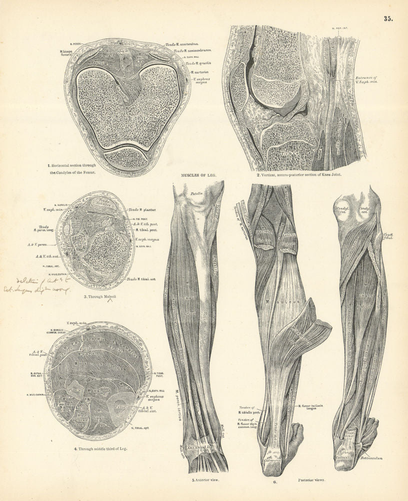 Anatomy. Muscles of Leg 1880 old antique vintage print picture ...
