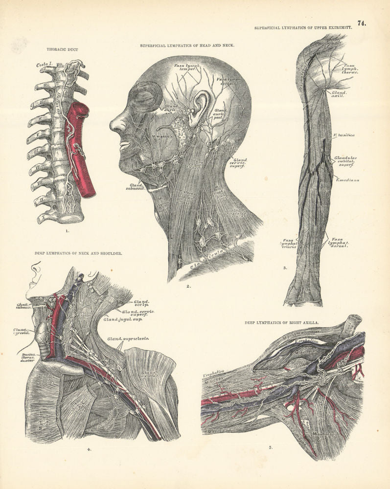 Anatomy. Thoracic Duct; Head, Neck, Upper Extremity Lymphatics 1880 old ...