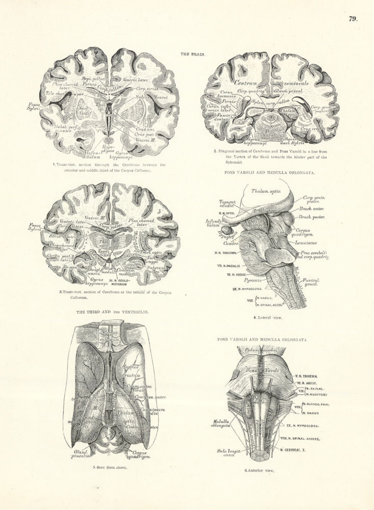 Anatomy. Brain, Pons Varolii, Medulla Oblongata, 3rd & 5th Ventricles ...